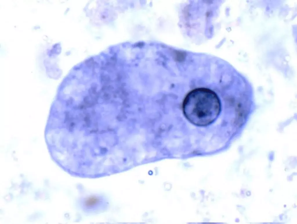 Dysentery amoeba (Entamoeba histolytica).