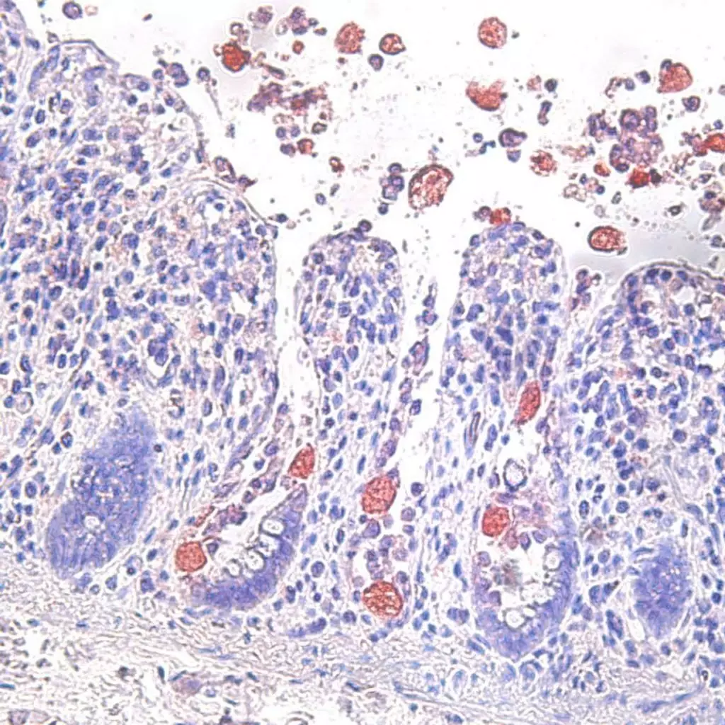 Dysentery amoeba (Entamoeba histolytica), einfaldasta í röð amoeba.