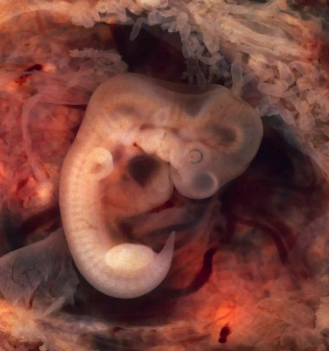 In to je mesečni človeški zarodek ... poglejte natančneje: opazite podobnost?