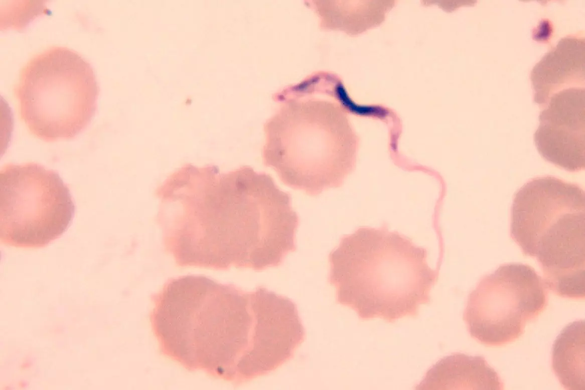 Trypanosoma - bu chivinlar orqali o'tadigan uyqu kasalligining qo'zg'atuvchisi