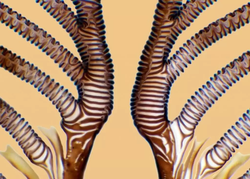 750x മാഗ്നിഫിക്കേഷനിൽ ശ്വാസനാളം പറക്കുക. (ഫോട്ടോ റെയ്മണ്ട് മോറിസൺ സ്ലോസ്, യുകെ.