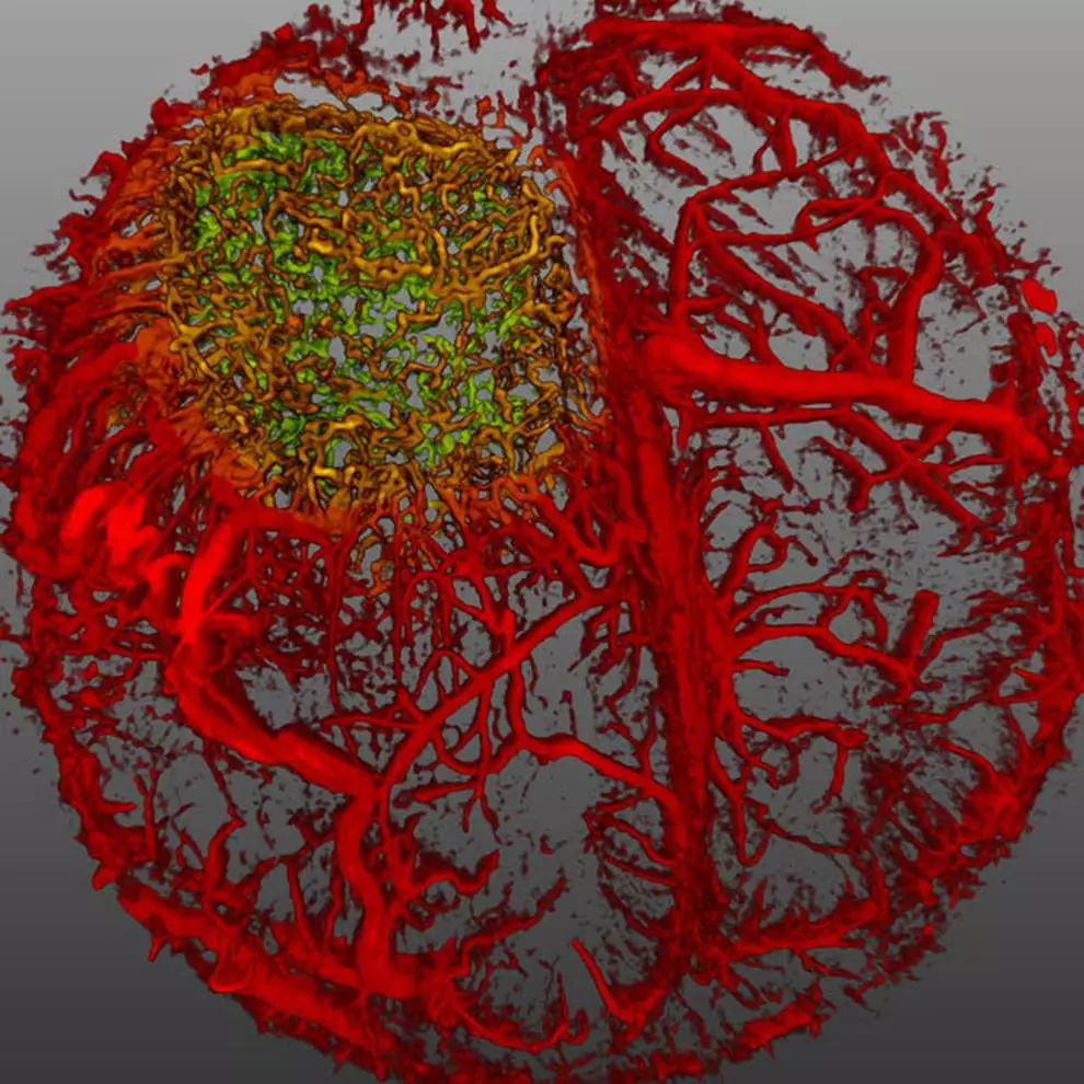تصاویر زنده از پرفیوژن مغزی موش مبتلا به گلیوبلاستوما (عکس از: دکتر جورجیو سئانو و دکتر راکش جین جین ، ماساچوست ، ایالات متحده).