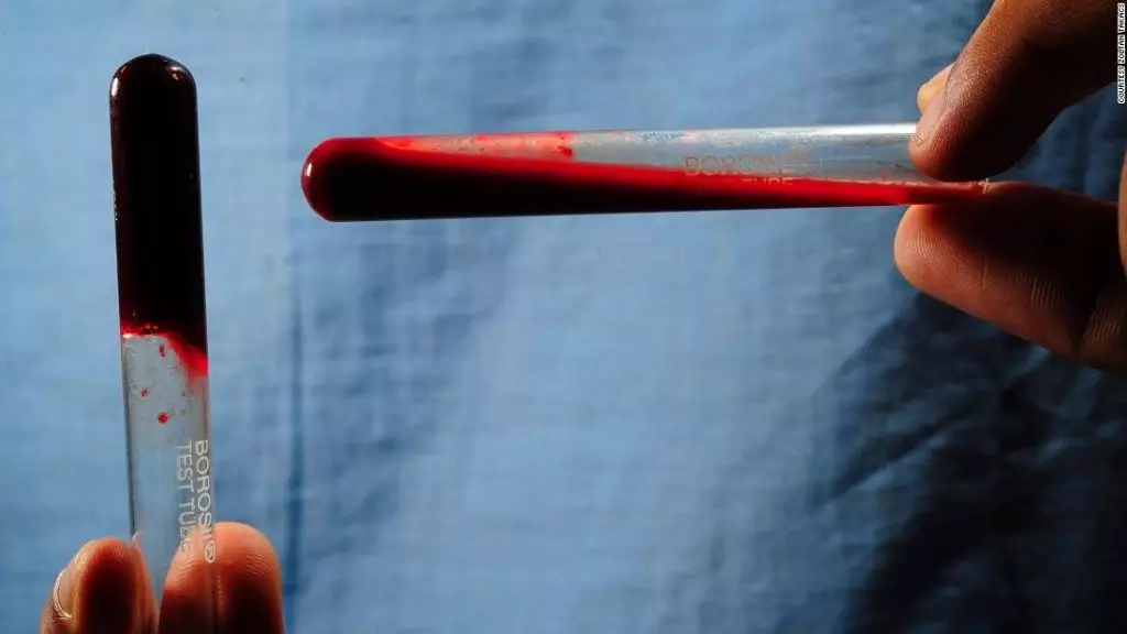 Nagu teate, takistab rästikumürk vere hüübimist, mis võimaldab seda kasutada antikoagulantidena. Fotol vasakul: normaalse verehüübimisega terve inimese veri, pärast kahekümneminutilist testi; paremal: mägirästiku hammustatud inimese veri 20 minuti pärast.